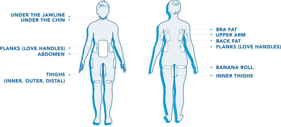 CoolSculpting Atlanta, Marietta, Sandy Springs